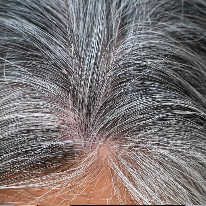 Grey Hair – ADC Pharmacy