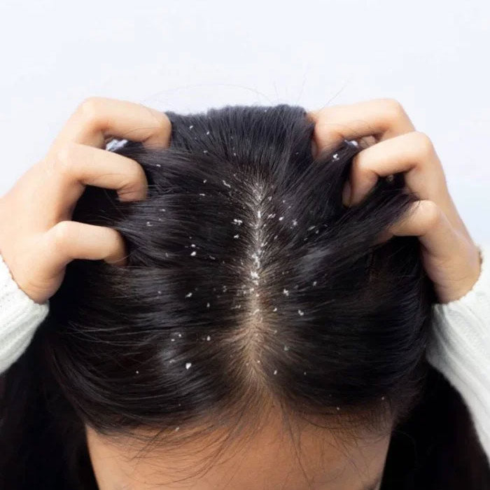 Shop Anti Dandruff Products Online | ADC Pharmacy